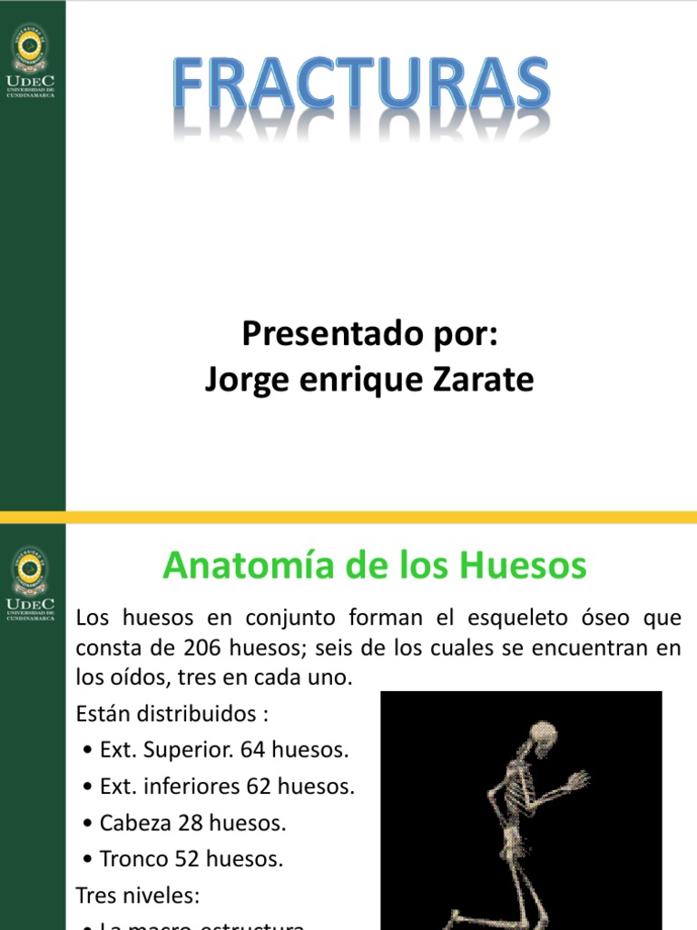 Clasificación y tipos de fracturas | PDF | Hueso | Ct Scan