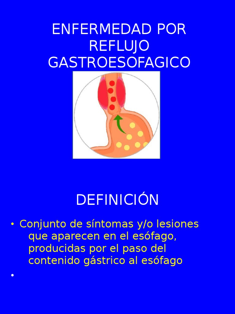 Enfermedad Por Reflujo Gastroesofagico | PDF | La enfermedad por ...