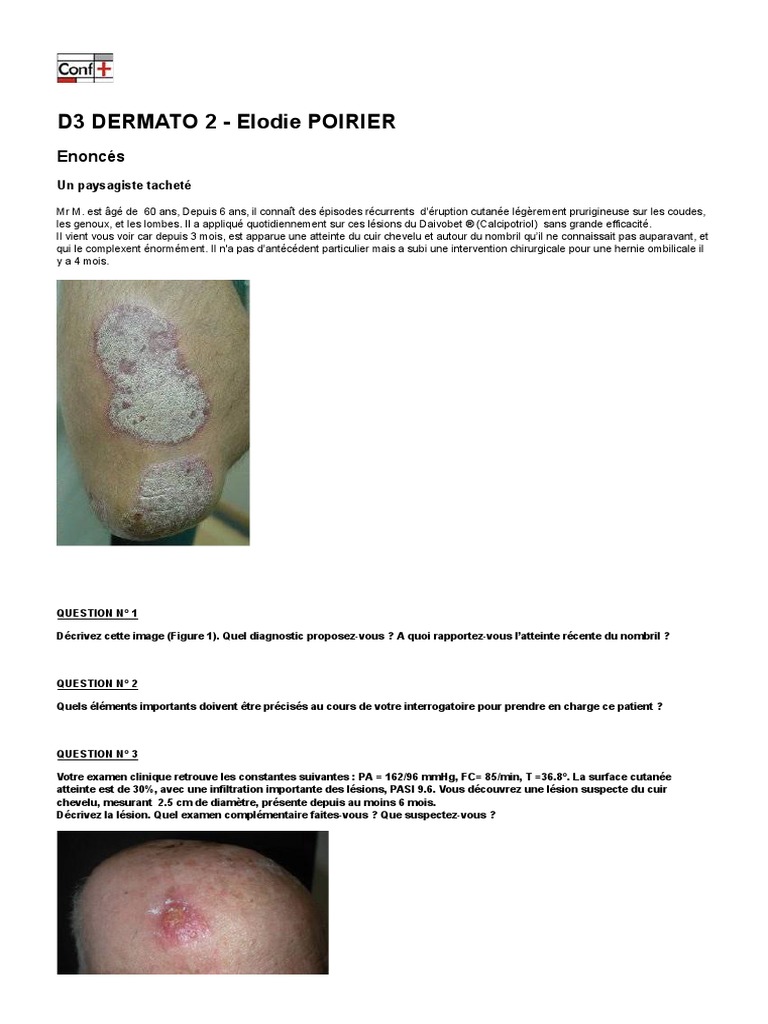 d3 Dermato 2 - Elodie Poirier | PDF | Psoriasis | Médecine