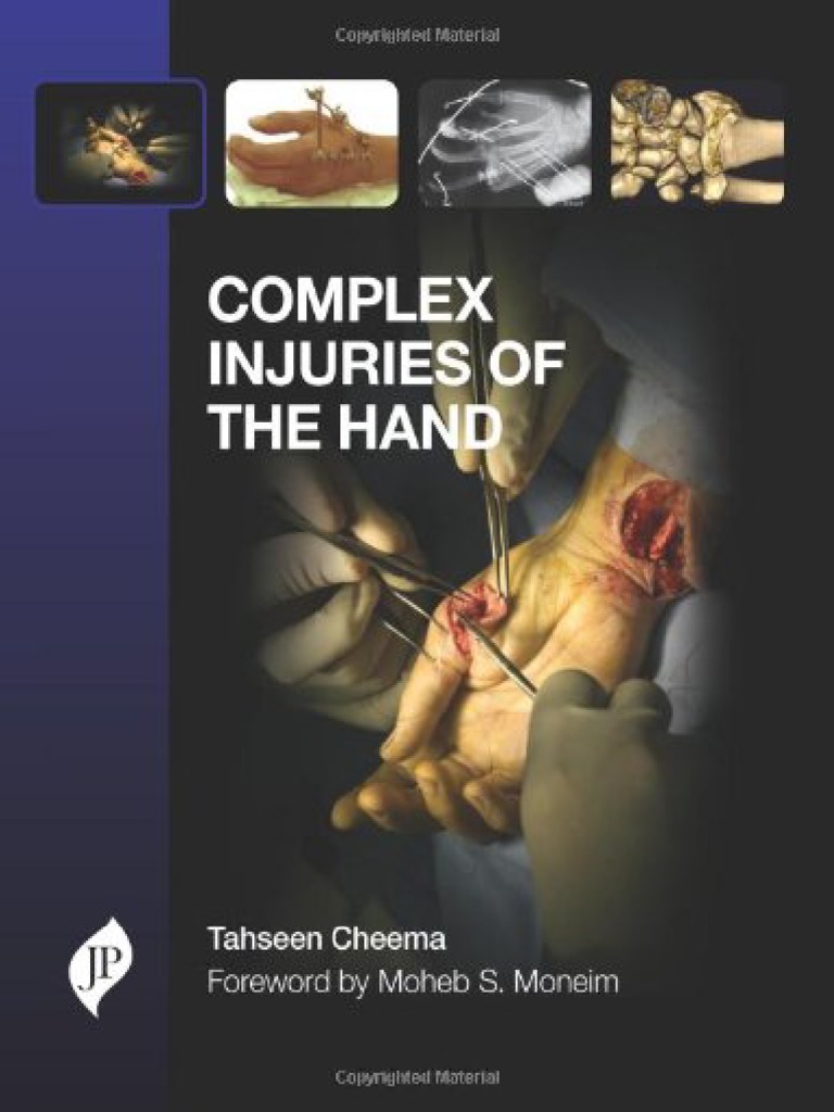 Complex Injuries of The Hand | PDF | Surgery | Amputation