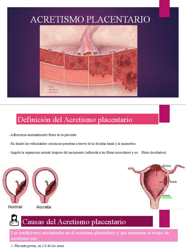 Acretismo Placentario | PDF | Placenta | Especialidades Medicas