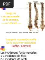 Interprétation RX Rachis Cervical | PDF | Vertèbre | Colonne vertébrale