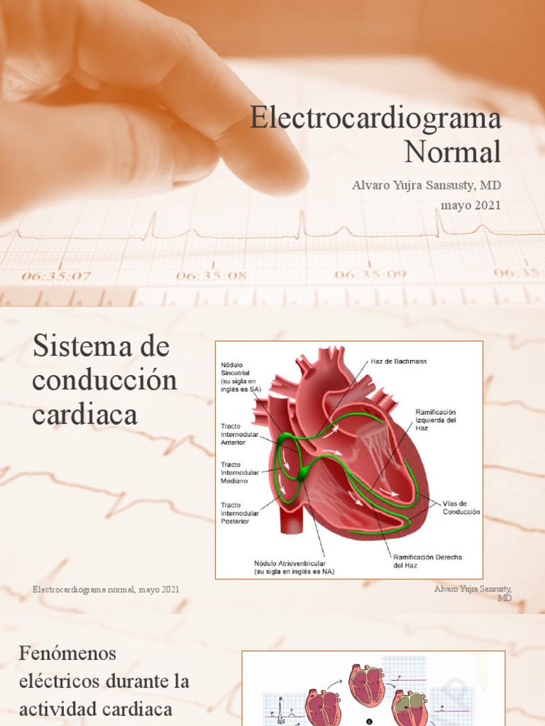 A Guide to Normal Electrocardiogram Characteristics | PDF ...