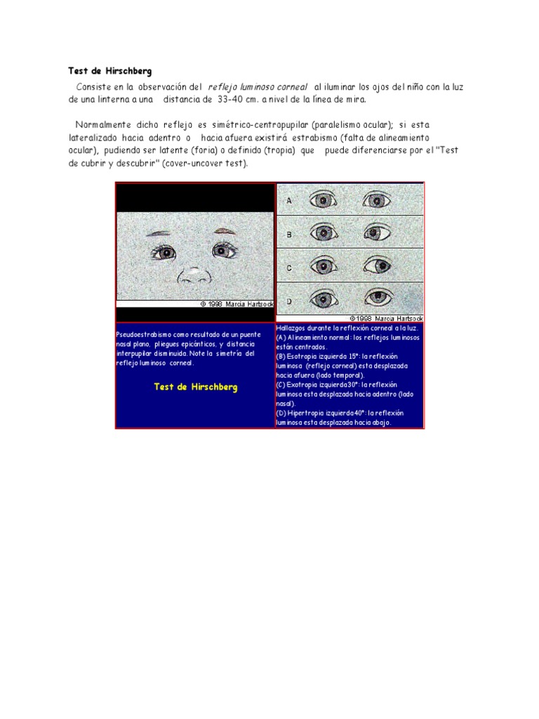 Test de Hirschberg | PDF