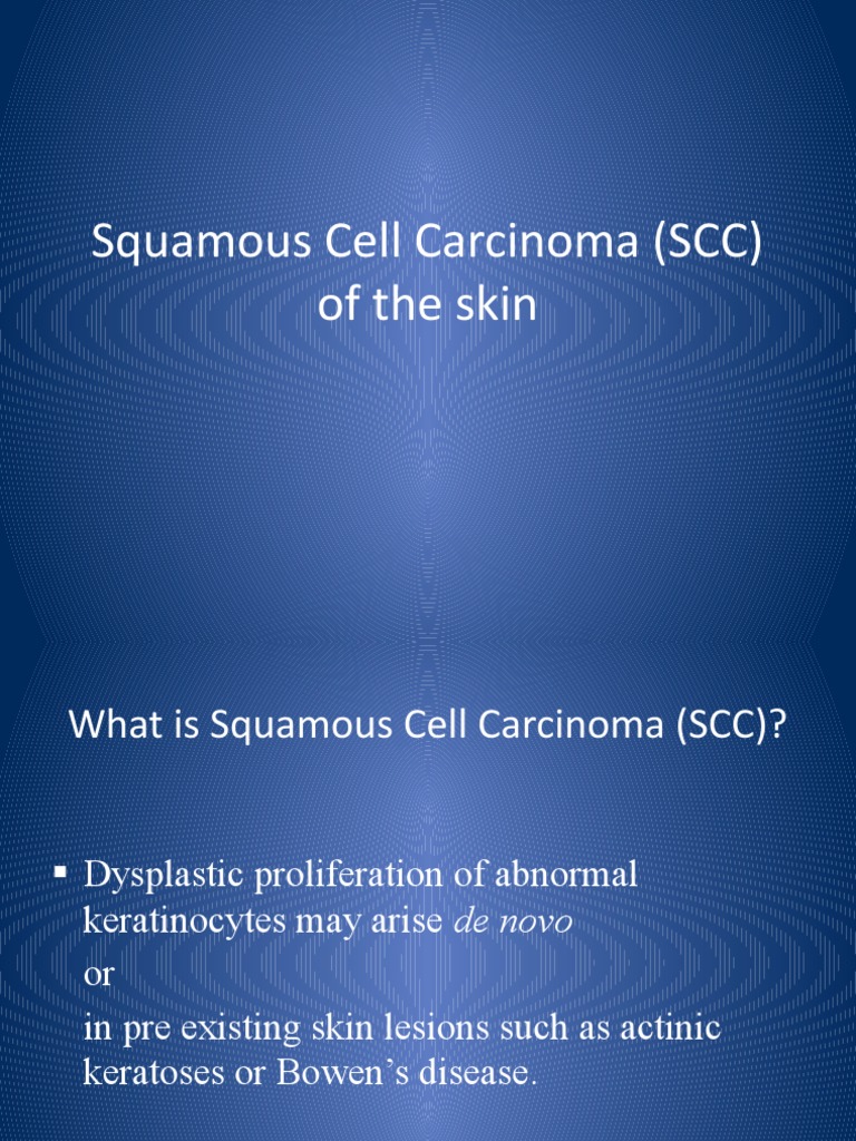 Squamous Cell Carcinoma (SCC) of The Skin | PDF | Clinical Medicine ...