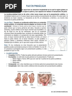 Parto Podálico: Procedimientos y Maniobras | PDF | Parto | Pelvis