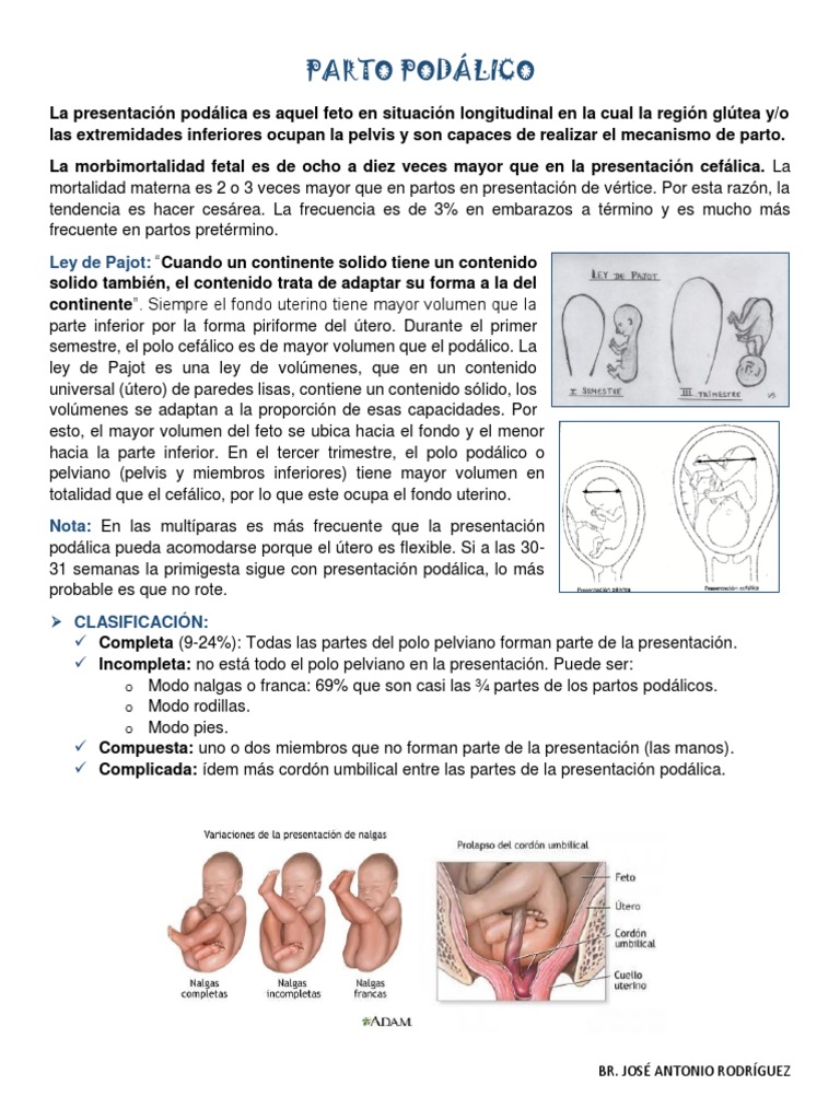 Manejo del Parto Podálico: Riesgos y Maniobras | PDF | Parto ...