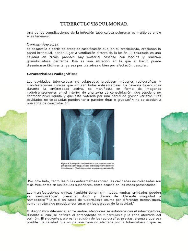 Caverna Tuberculosa en Tuberculosis Pulmonar | PDF | Tuberculosis ...