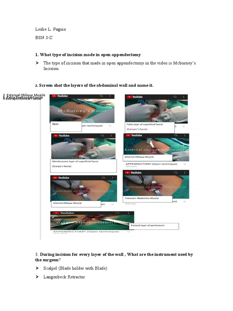 What Type of Incision Made in Open Appendectomy | PDF