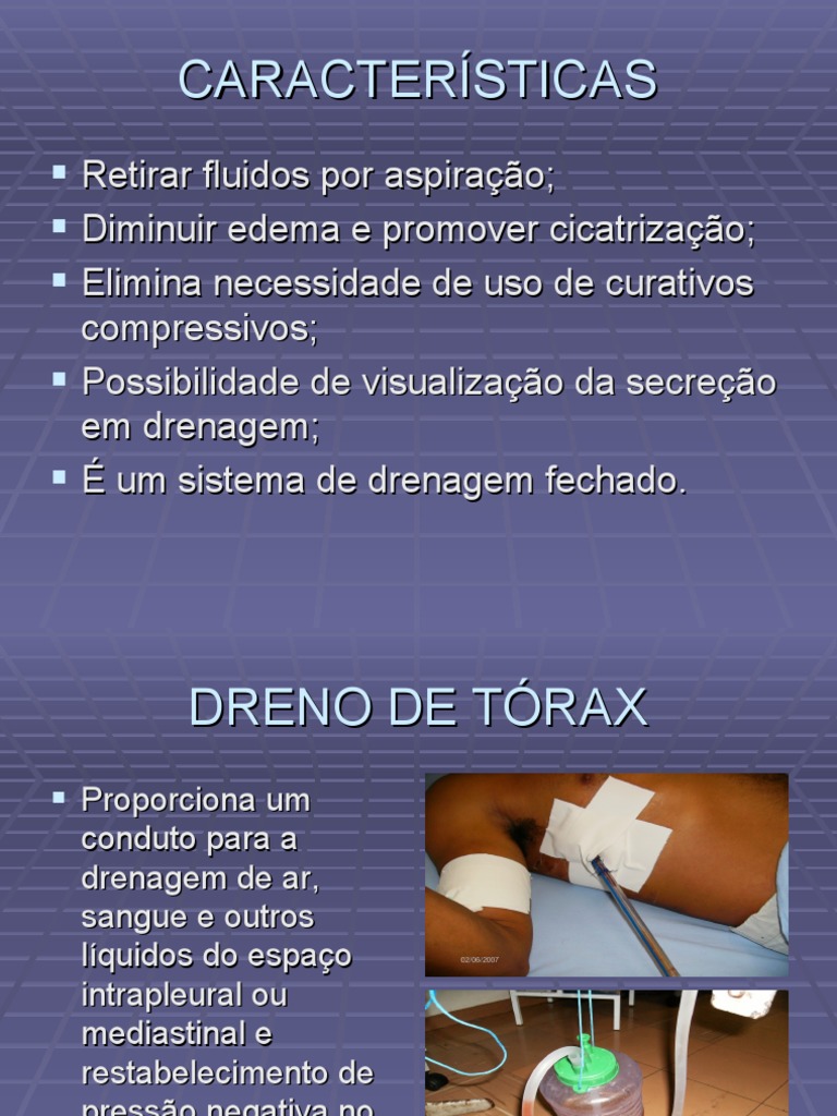 Aula Drenos 3 | PDF | Medicina Clínica | Especialidades médicas