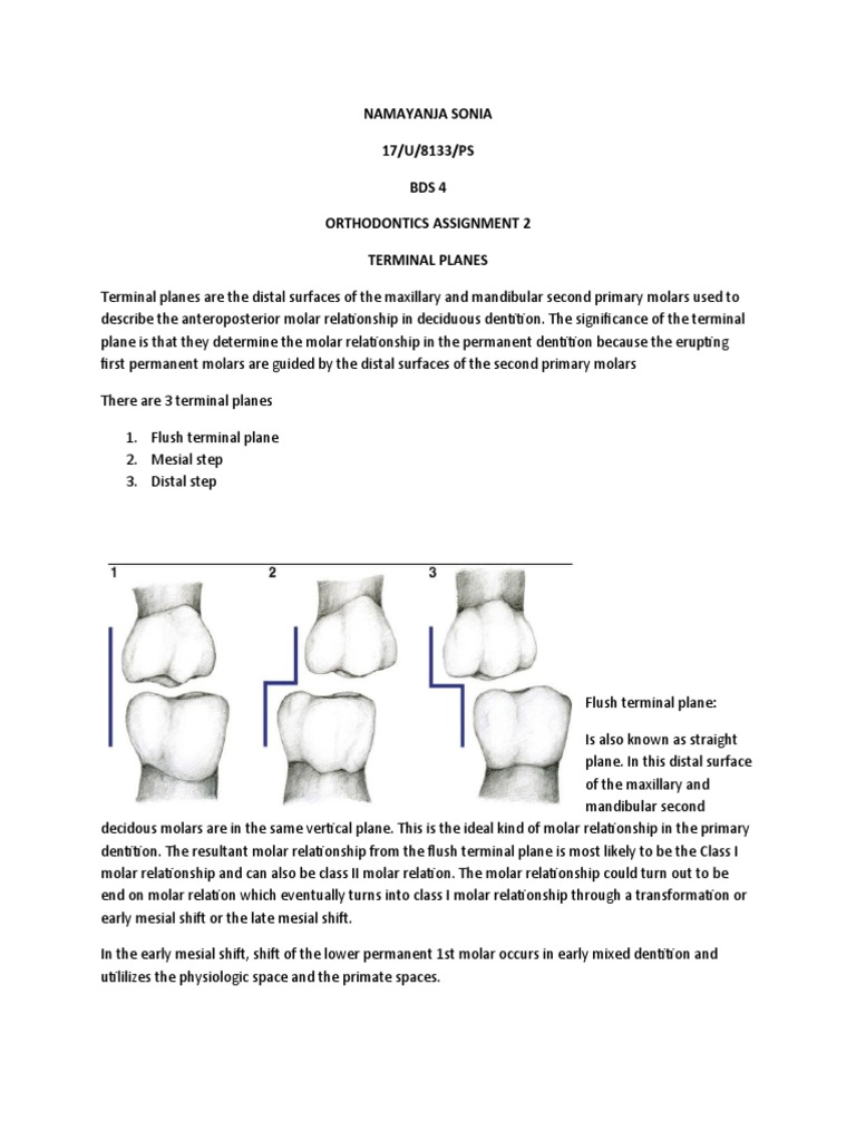 Effects of Terminal Planes on Occlusion Development | PDF | Human Head ...