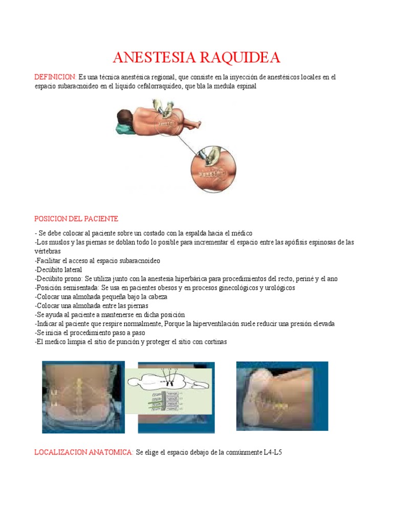 Técnica y Posición en Anestesia Raquídea | PDF | Fluido cerebroespinal ...