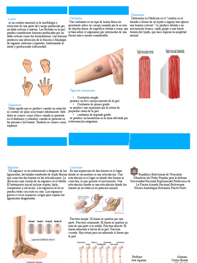 Lesiones y distensiones musculares en | PDF | Hueso | Articulación