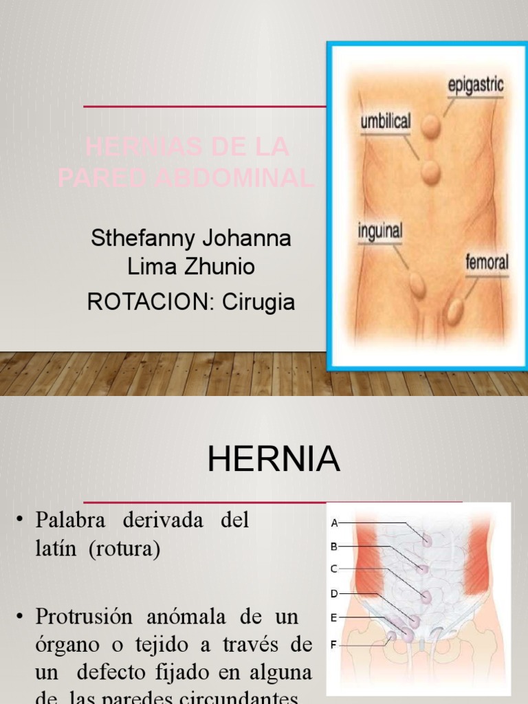 Hernias de La Pared Abdominal | PDF | Abdomen | Músculo