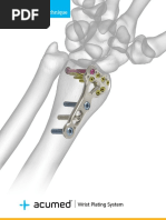 Medartis Distal Radius Surgical Technique | PDF | Drill | Limbs (Anatomy)