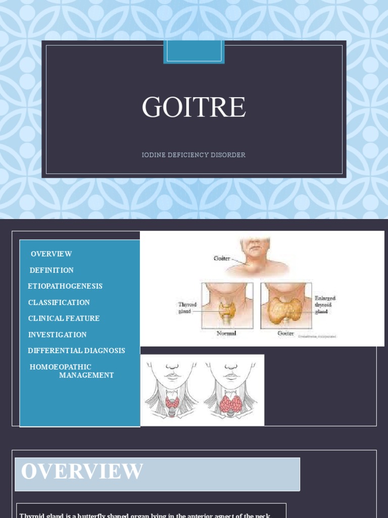 Goitre: Iodine Deficiency Disorder | PDF