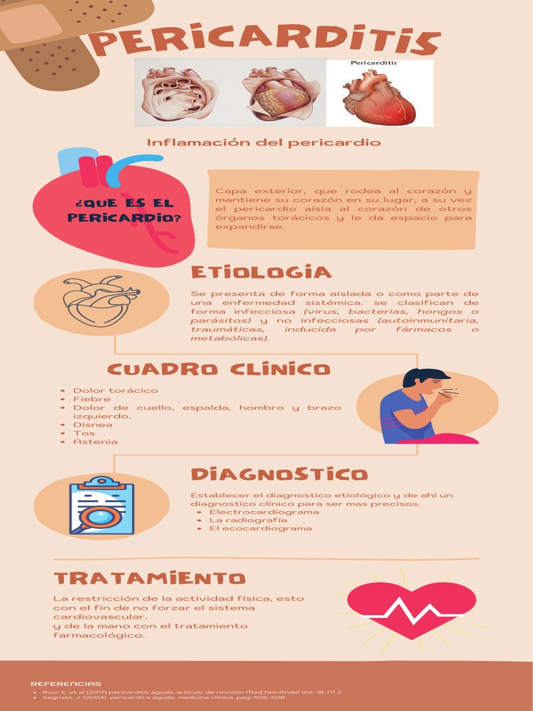 Pericarditis Infografia | PDF