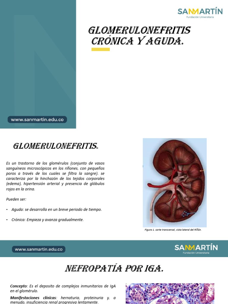 Glomerulonefritis Cronica y Aguda | PDF | Riñón | Especialidades Medicas
