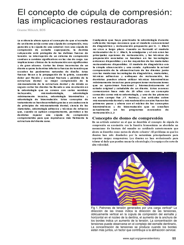 Milicich 2017 The Compression Dome Concept ESP | PDF | Odontología ...