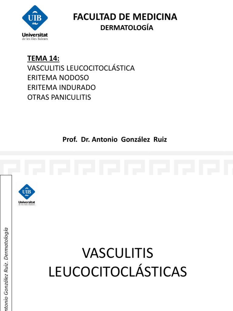 Vasculitis, Paniculitis | PDF | Epidemiología | Medicina