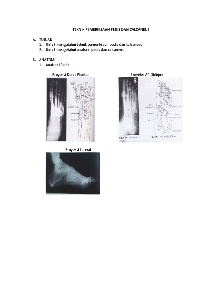 Laporan (Pedis Dan Calcaneus) | PDF | Ilmu Sosial