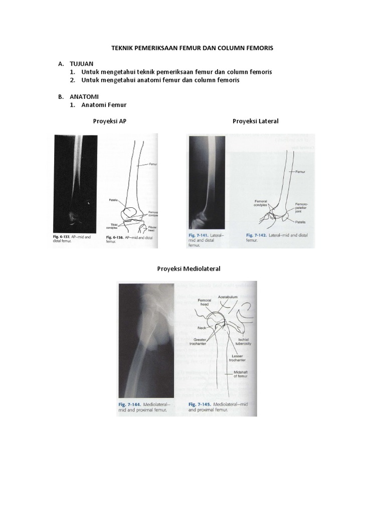 Laporan FEMUR DAN COLUMN FEMORIS | PDF