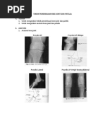 Laporan (Os - Manus Dan Wrist Joint) | PDF