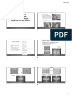 Códigos ICDAS para Diagnóstico de Caries | PDF | Esmalte de dientes | Flúor