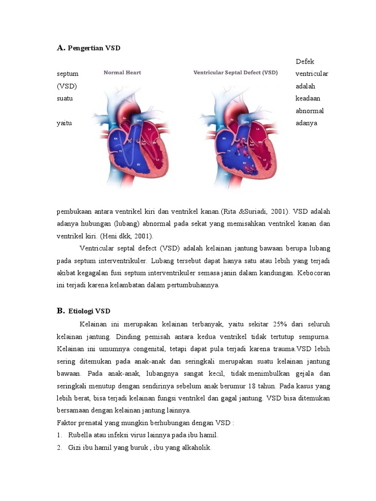 Pembahasan VSD | PDF