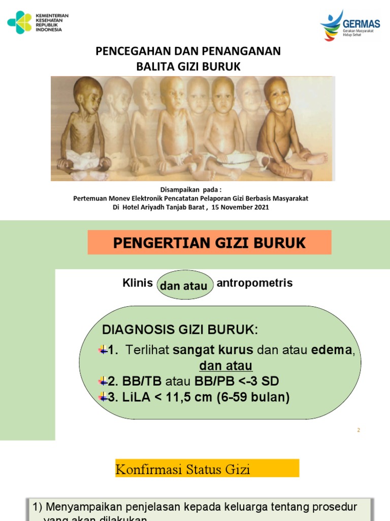 Tatalaksana Balita Gizi Buruk | PDF
