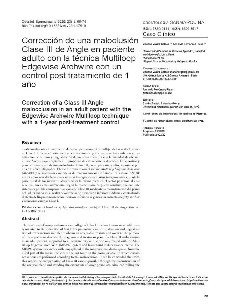 Corrección de Una Maloclusión Clase III de Angle en Paciente Adulto Con ...