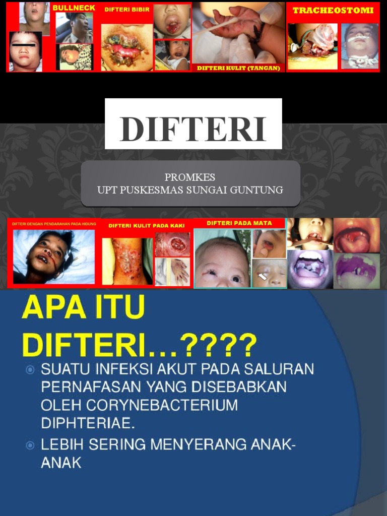 DIFTERI | PDF