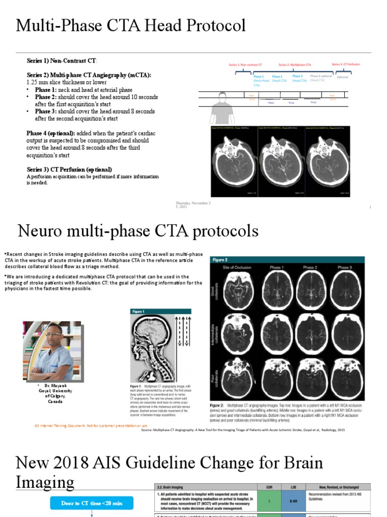 Multi-Phase CTA Head Imaging Protocol | PDF | Ct Scan | Stroke