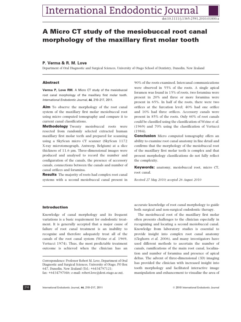 A Micro CT Study of The Mesiobuccal Root Canal Morphology of The ...