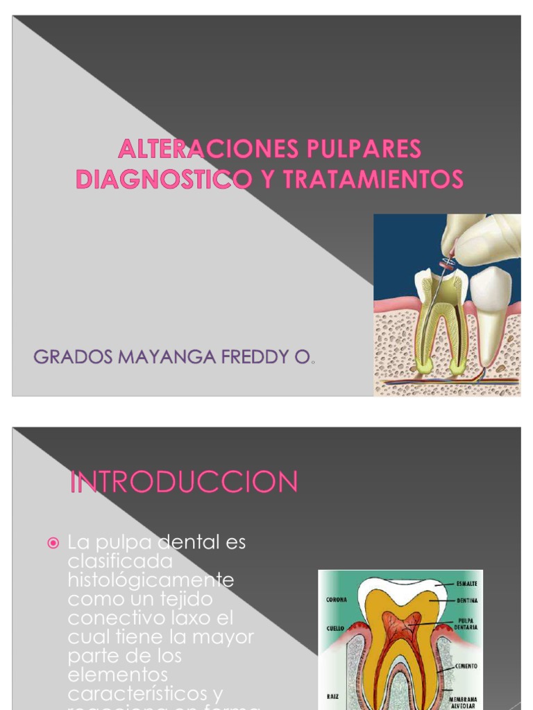 Alteraciones Pulpares Diagnostico y Tratamientos