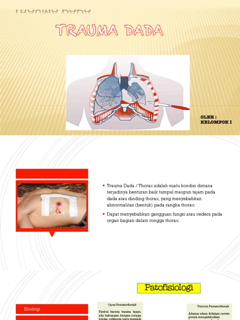 Gadar Trauma Dada | PDF