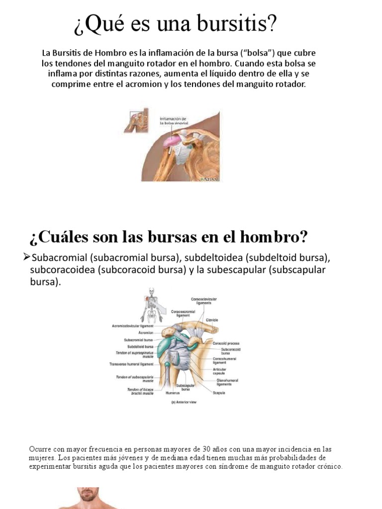 Bursitis de Hombro: Causas y Tratamiento | PDF | Hombro | Ciencias de ...