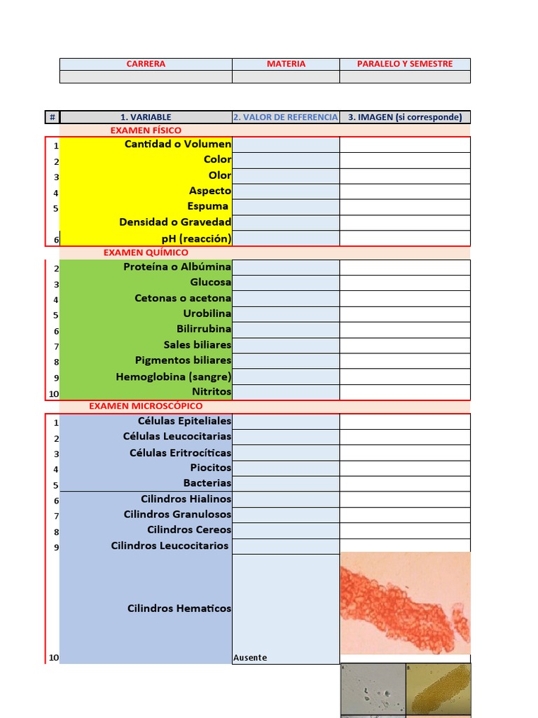 Cilindros Hematicos y Mixtos | PDF | Sangre | Especialidades Medicas