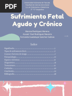 Distocia Funicular | PDF | Parto | Feto