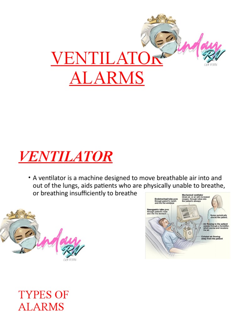 Ventilator Management | PDF