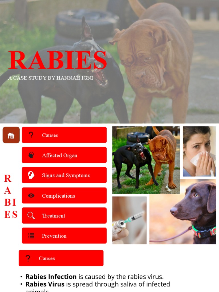 Rabies: A Case Study by Hannah Igni | PDF | Rabies | Clinical Medicine