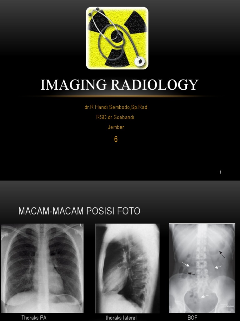 NORMAL AND ABNORMAL FINDINGS IN IVP | PDF