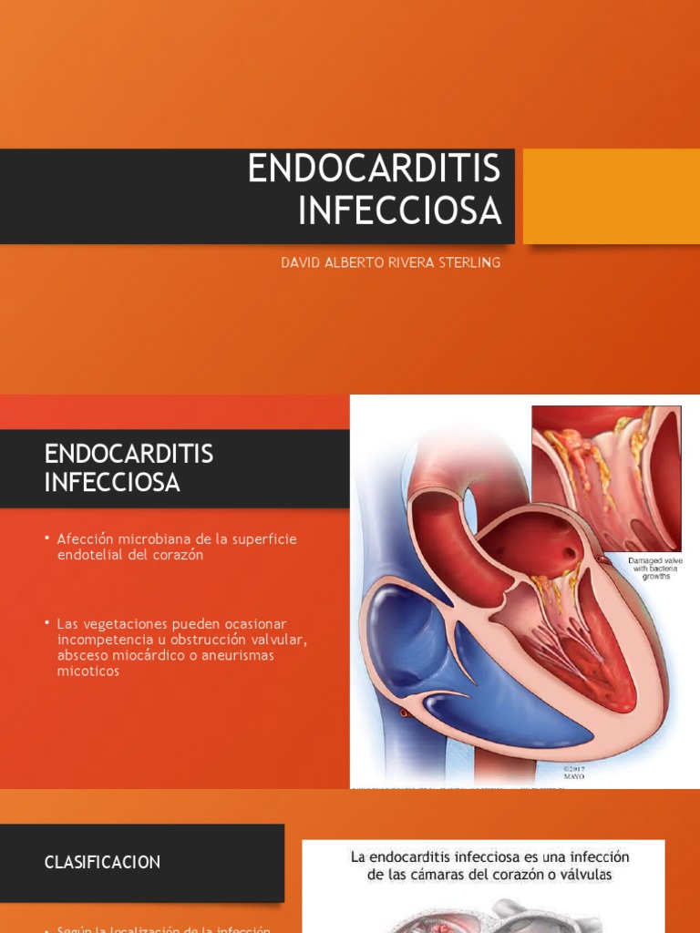 Endocarditis Infecciosa | PDF | Medicina CLINICA | Especialidades Medicas