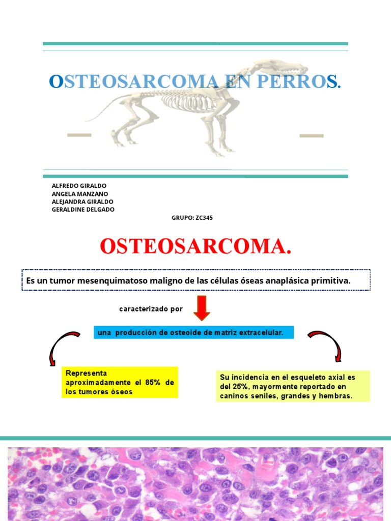 Osteosarcoma | PDF | Hueso | Cirugía