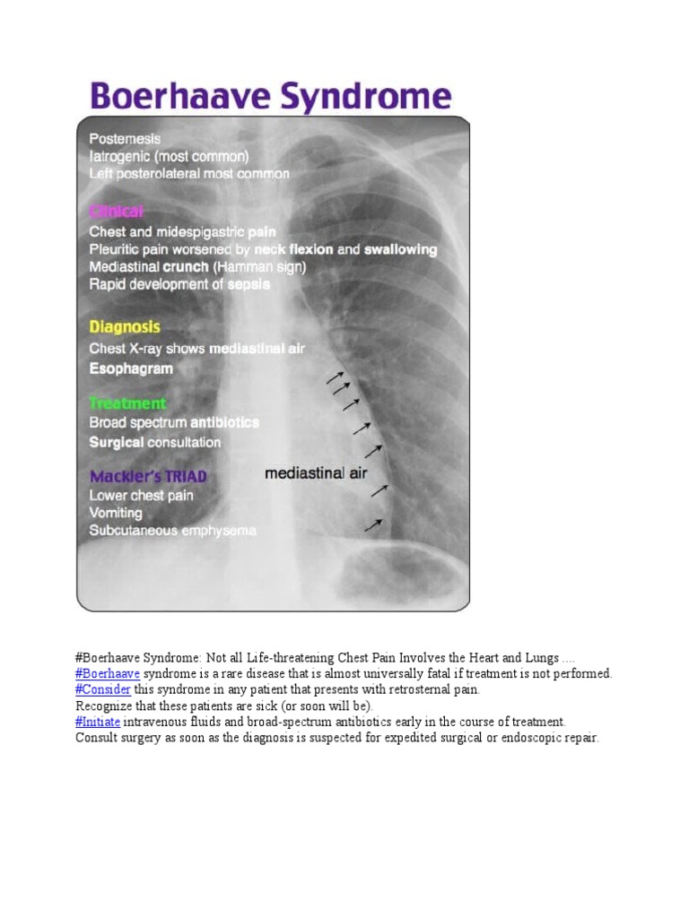 Boerhaave Syndrome | PDF