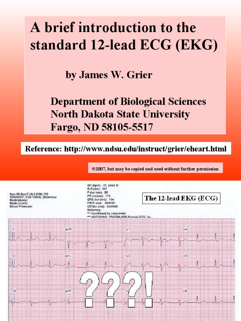 A Brief Introduction To The Standard 12-Lead ECG (EKG) | PDF ...