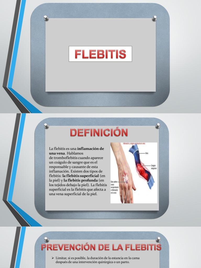 FLEBITIS | PDF