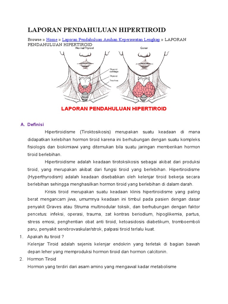 Laporan Pendahuluan Hipertiroid | PDF | Kesehatan Holistik