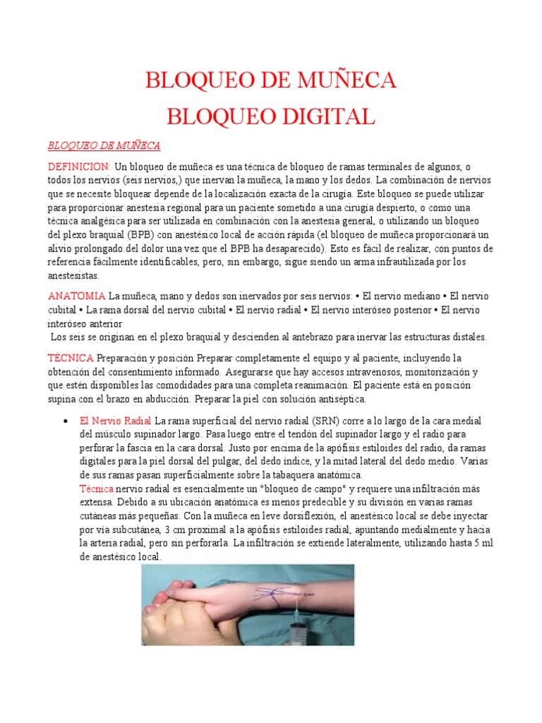 Técnicas de Bloqueo Anestésico en Mano | PDF | Mano | Sistema ...