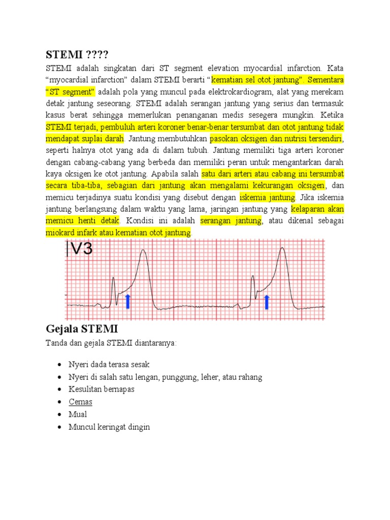 STEMI Adalah Serangan Jantung Yang Berbahaya | PDF